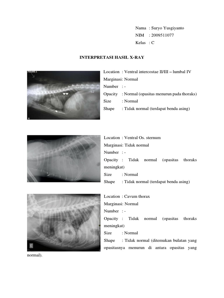 Interpretasi XRAY - Suryo Yusgiyanto - 2009511077 - C | PDF