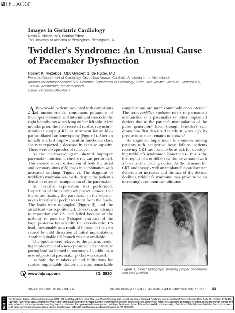 Twiddler's Syndrome: An Unusual Cause of Pacemaker Dysfunction | PDF ...