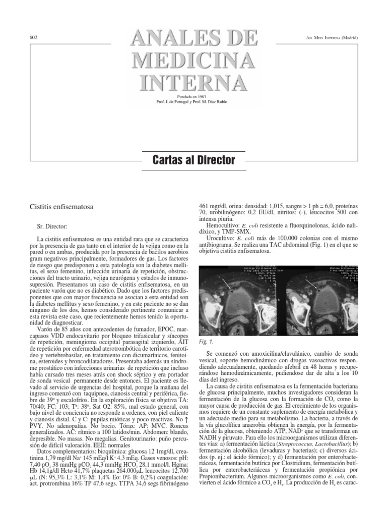 Cistitis | PDF