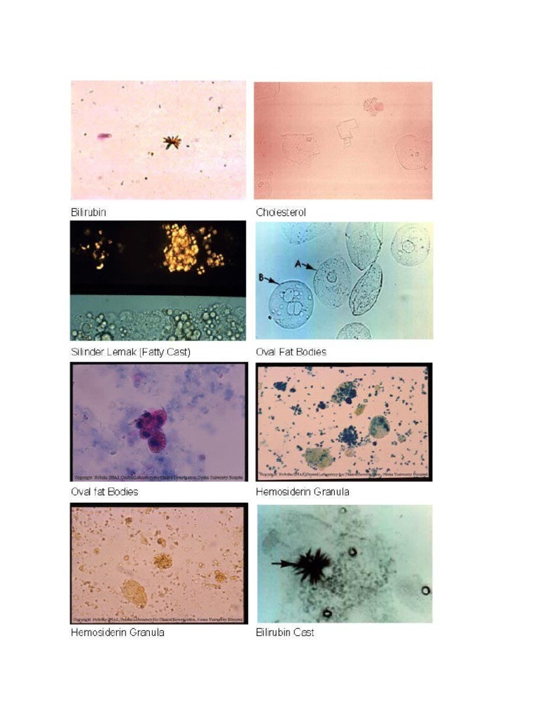 Sedimen Urine.2 | PDF