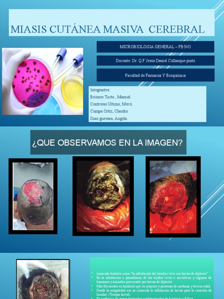 Miasis Cutánea Masiva Cerebral | PDF | Enfermedades y trastornos ...