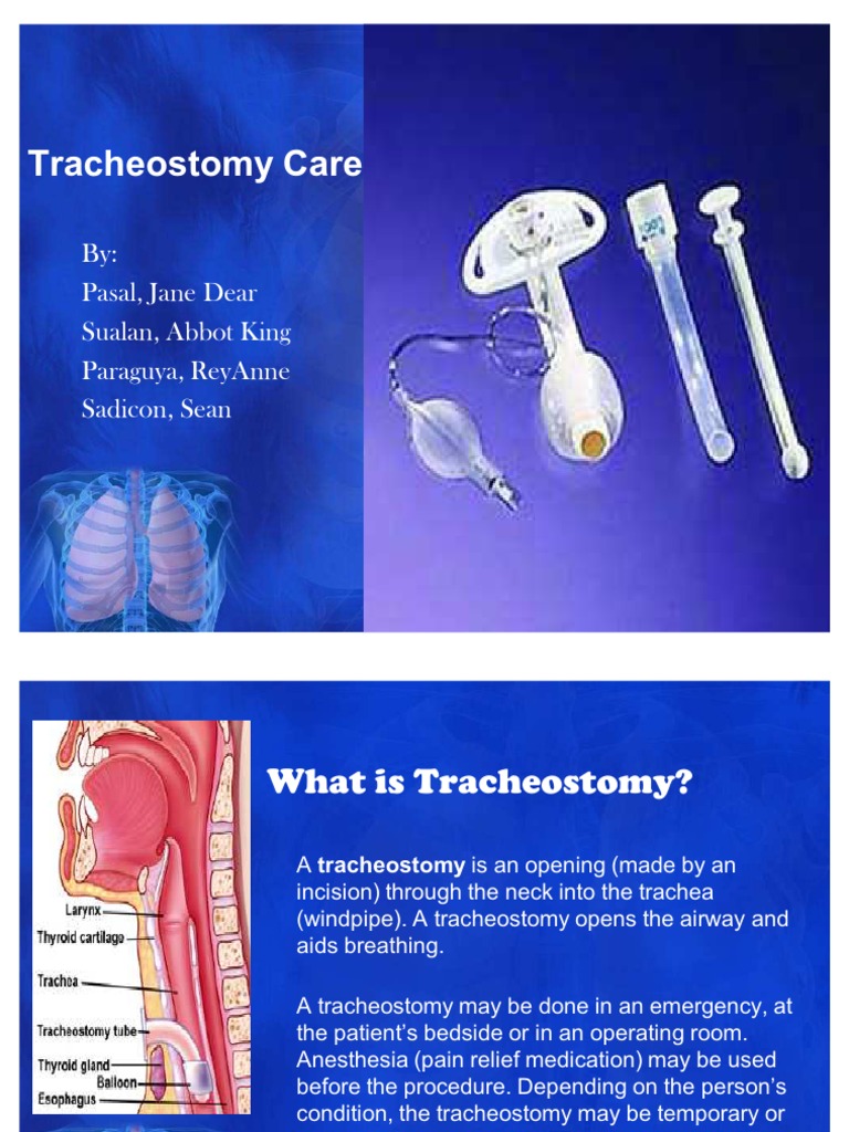 Tracheostomy Care: A Comprehensive Guide to Cleaning, Replacing and ...