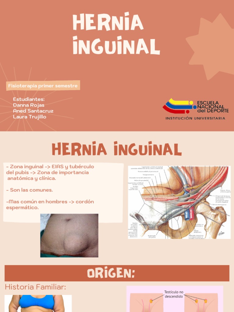 Hernia Inguinal | PDF | Salud y bienestar | Ciencia y matemáticas