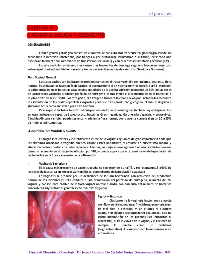 Vaginitis Aguda y Pip | PDF | Candidiasis | Enfermedades y trastornos