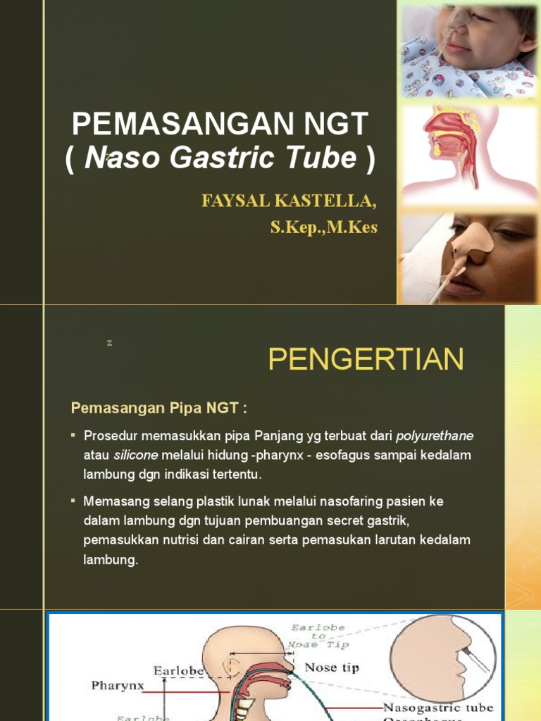 Pemasangan NGT & Memberi Makan Melalui NGT | PDF