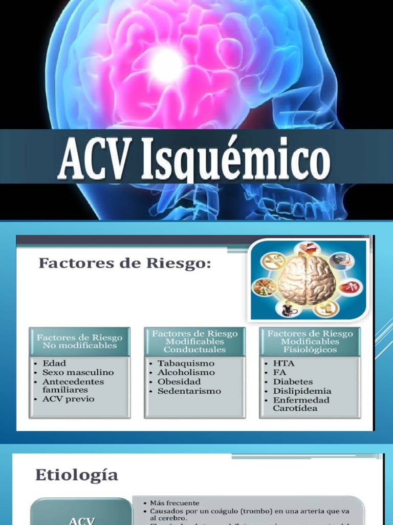 ACV Isquémico | PDF