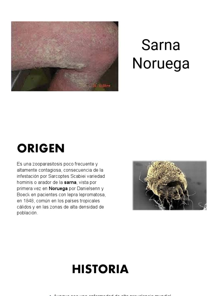 Sarna Noruega | PDF | Microbiología | Inmunología