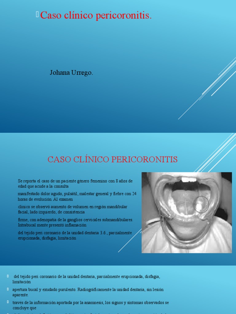 Periconitis | PDF