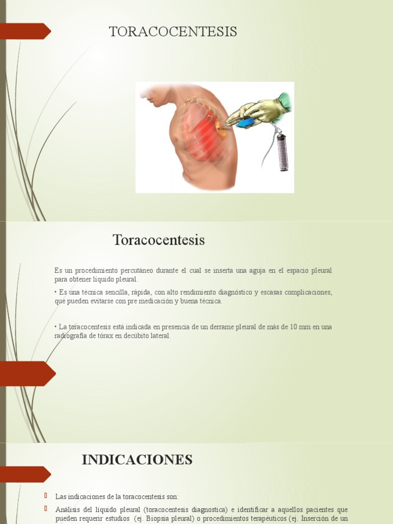 TORACOCENTESIS | PDF | Medicina CLINICA | Especialidades Medicas