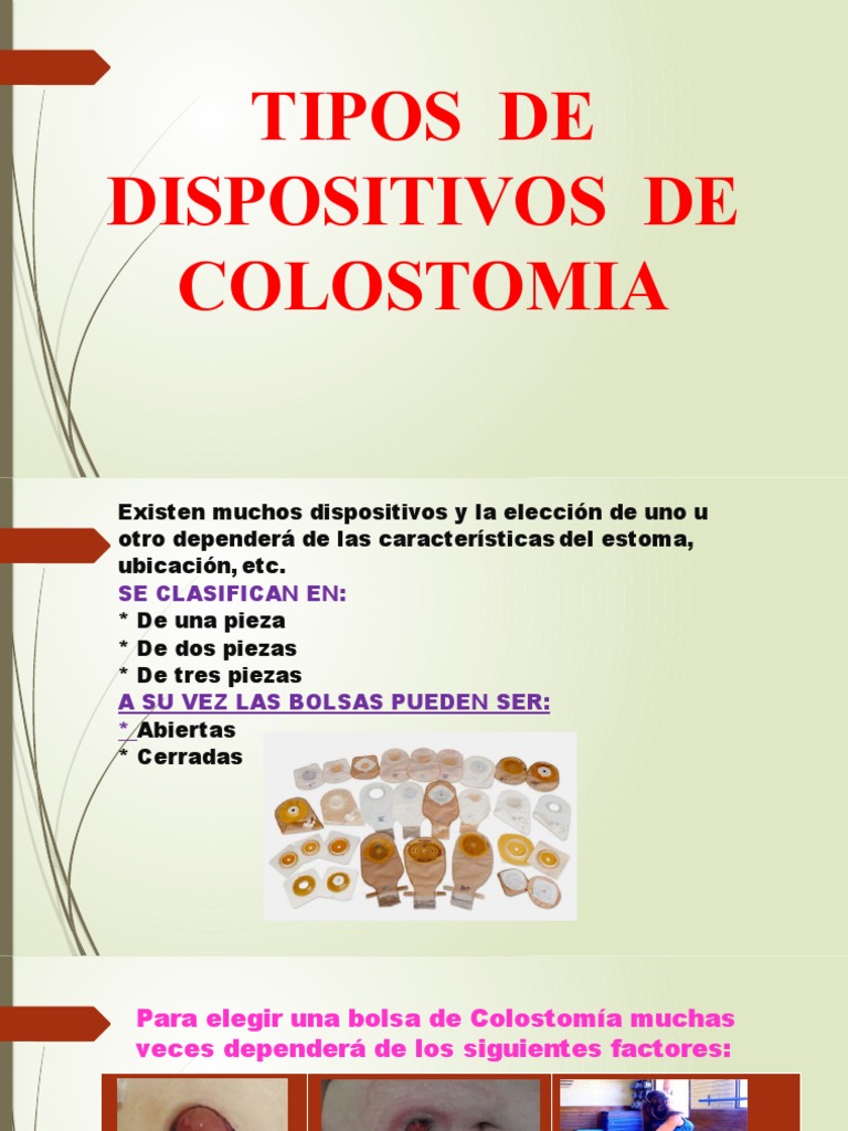 Tipos de Dispositivos de Colostomia | PDF