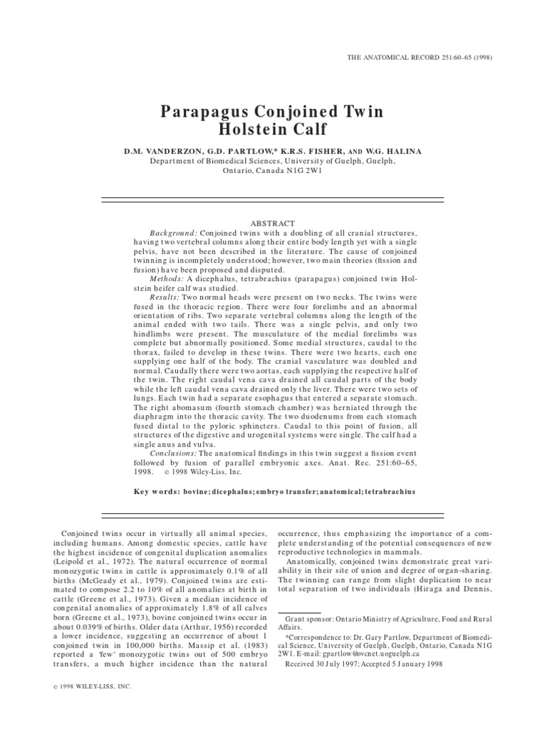 The Anatomical Record - 1998 - Vanderzon - Parapagus Conjoined Twin ...