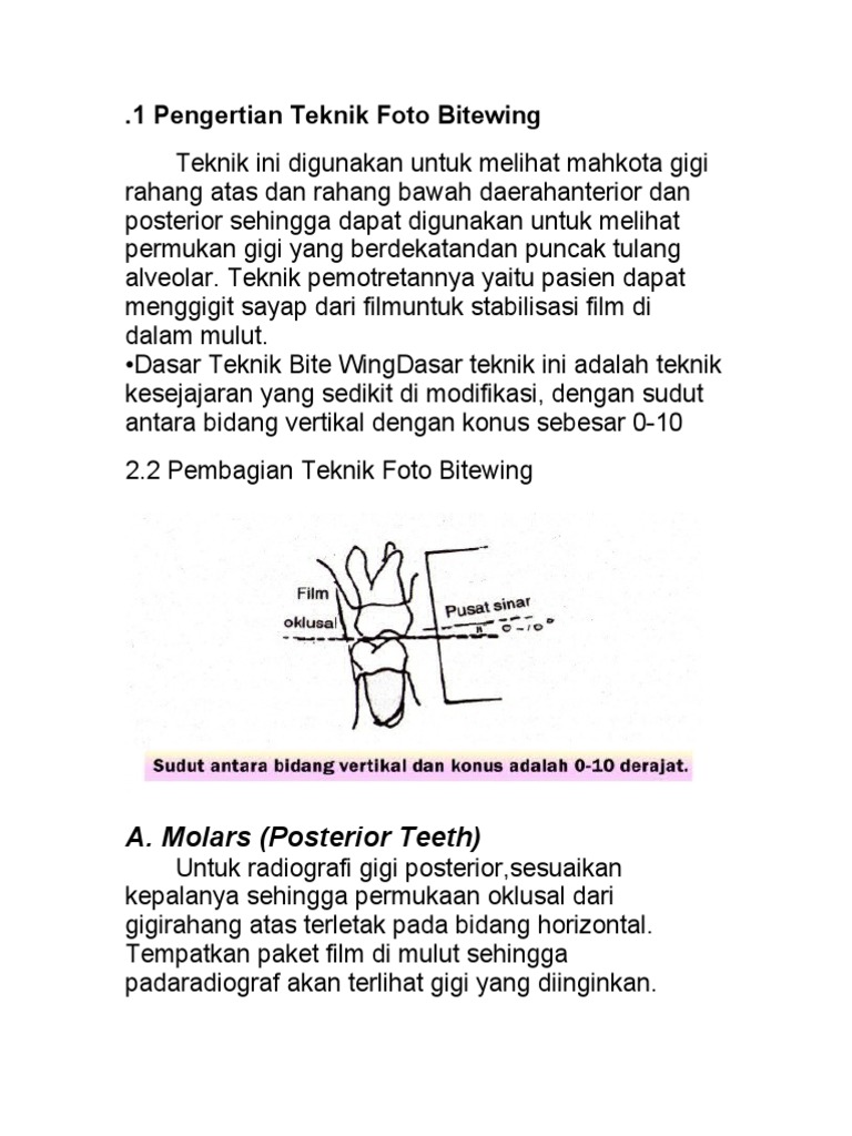 Teknik Foto Bitewing untuk Radiografi Gigi | PDF