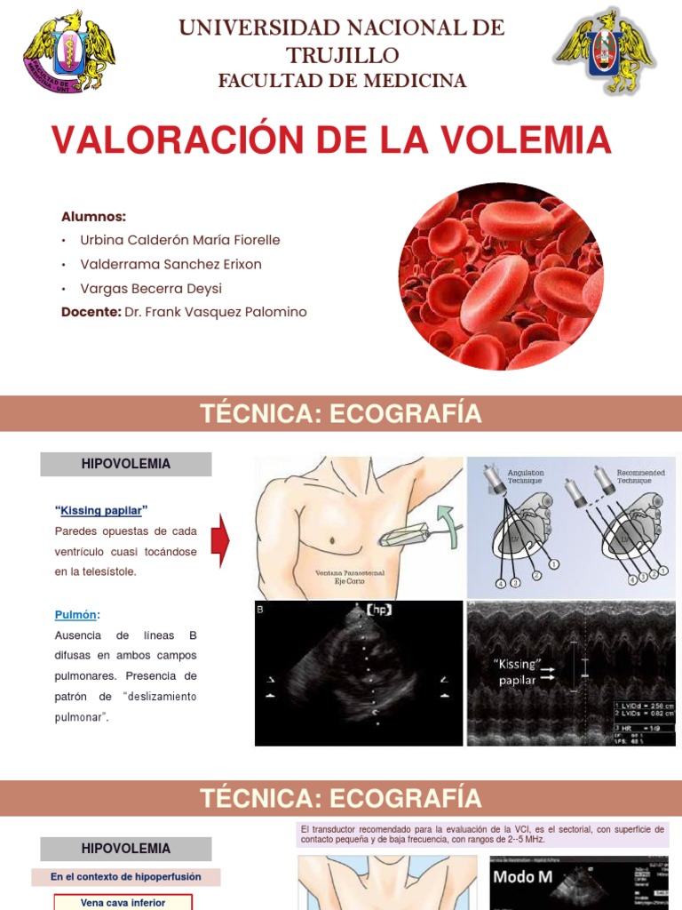 Valoración de La Volemia | PDF