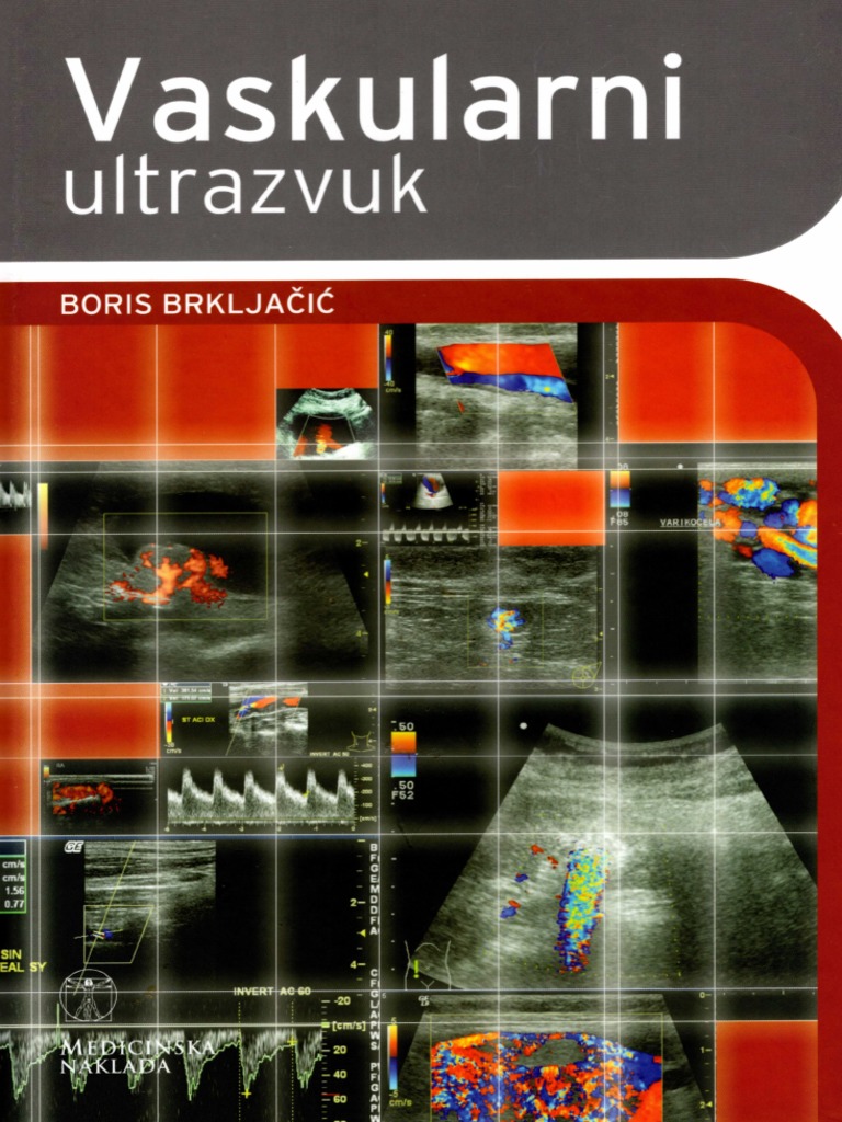 Vaskularni Ultrazvuk - Boris Brkljačić | PDF