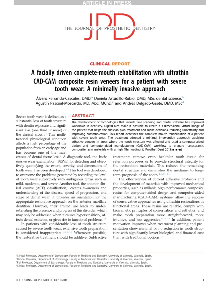 A Facially Driven Complete-Mouth Rehabilitation With Ultrathin CAD CAM ...