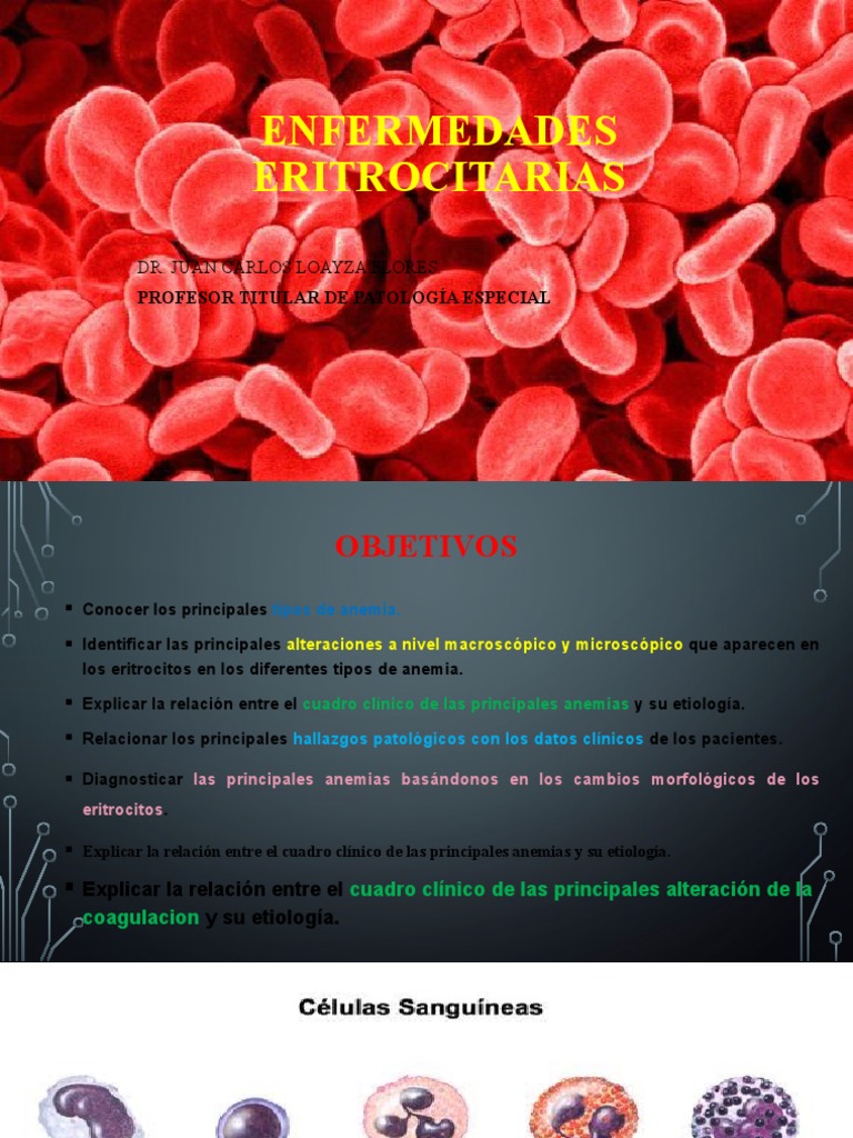 Esferocitos y Anemia Hemolítica | PDF | Coagulación | Glóbulo rojo
