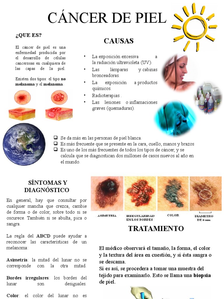 Cáncer de Piel | PDF