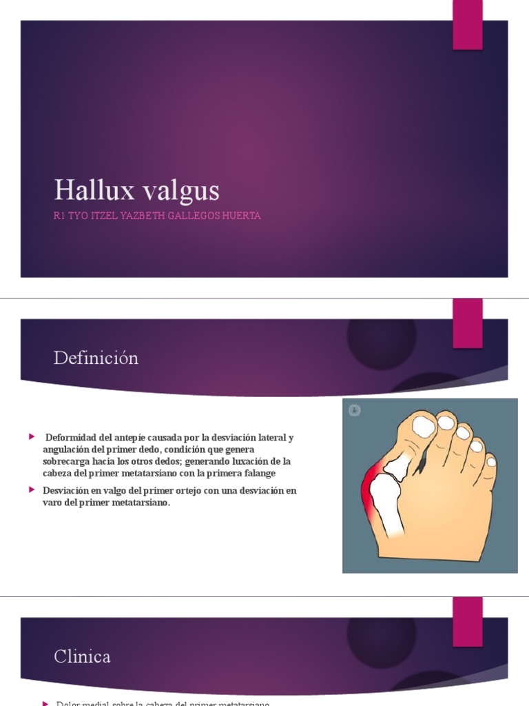 Angulos en Hallux Valgus y Tratamientos | PDF | Dedo del pie | Pie