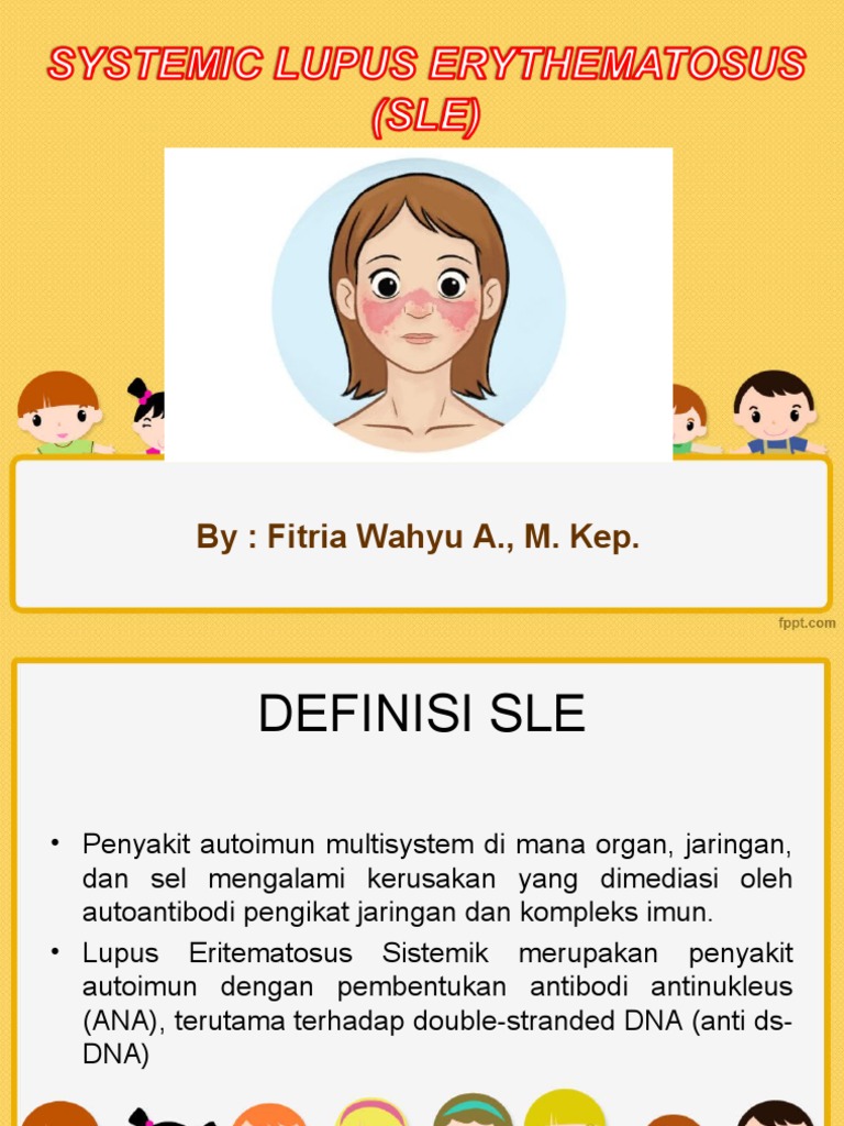 SLE pada Anak: Definisi dan Gejala | PDF