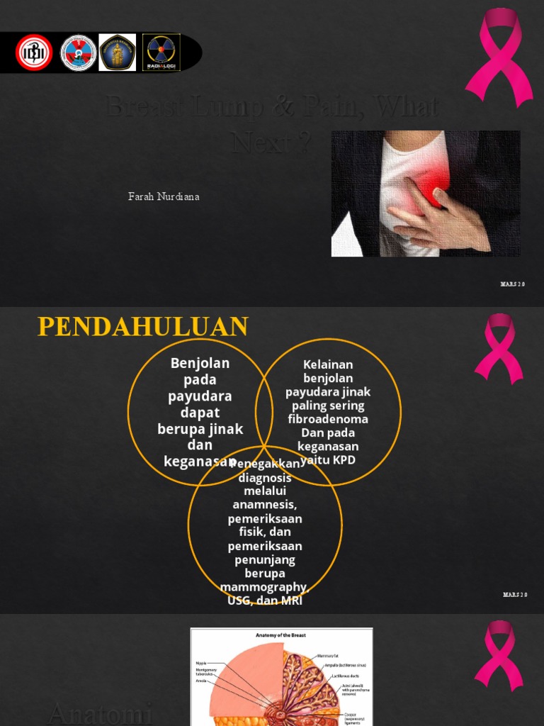 Panduan Benjolan & Nyeri Payudara | PDF