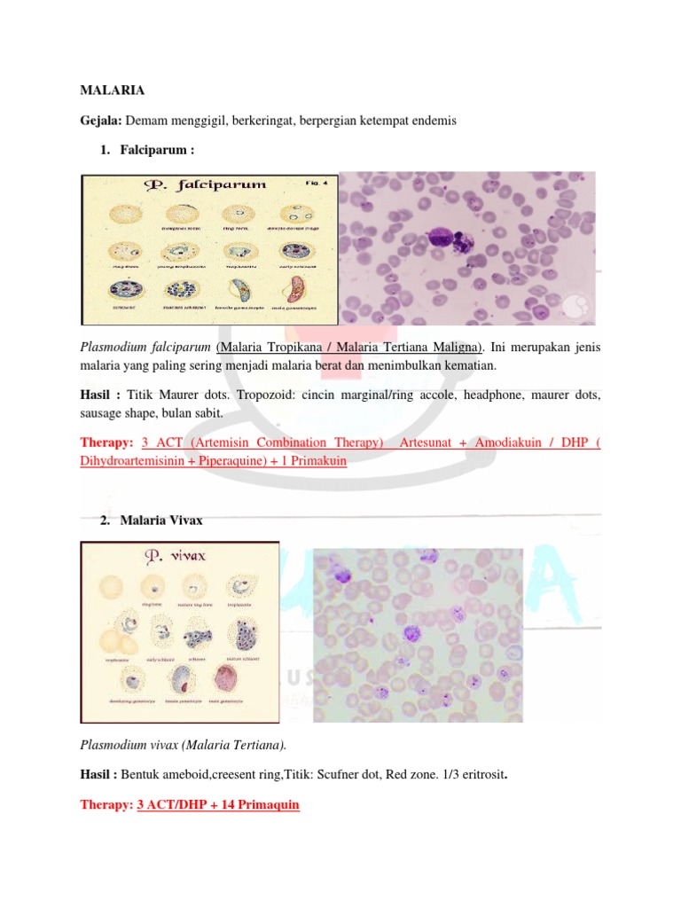 MENGENAL JENIS MALARIA DAN TERAPINYA | PDF