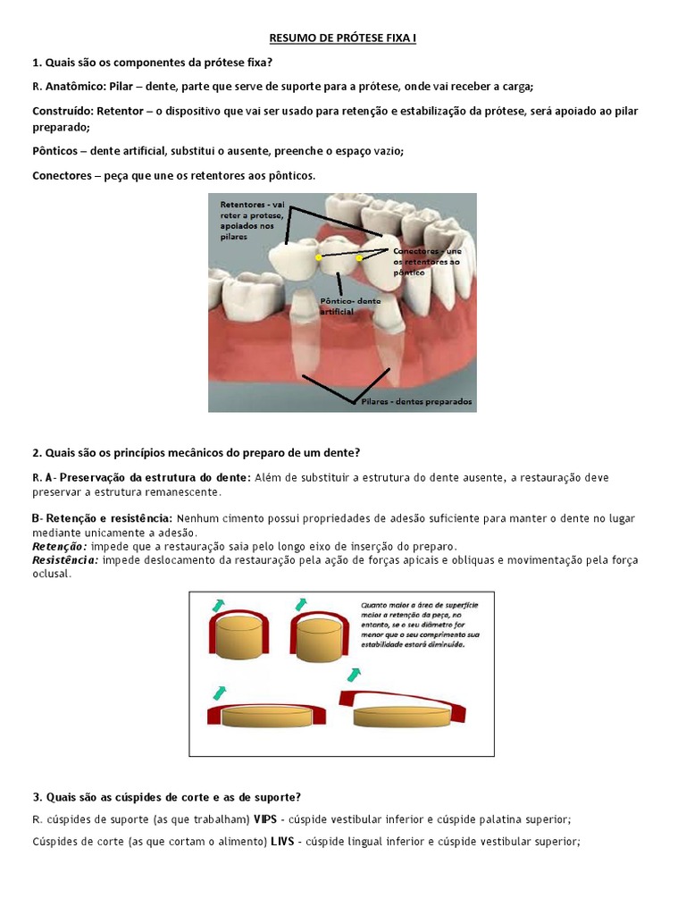 Resumo de Prótese Fixa I | PDF | Dente