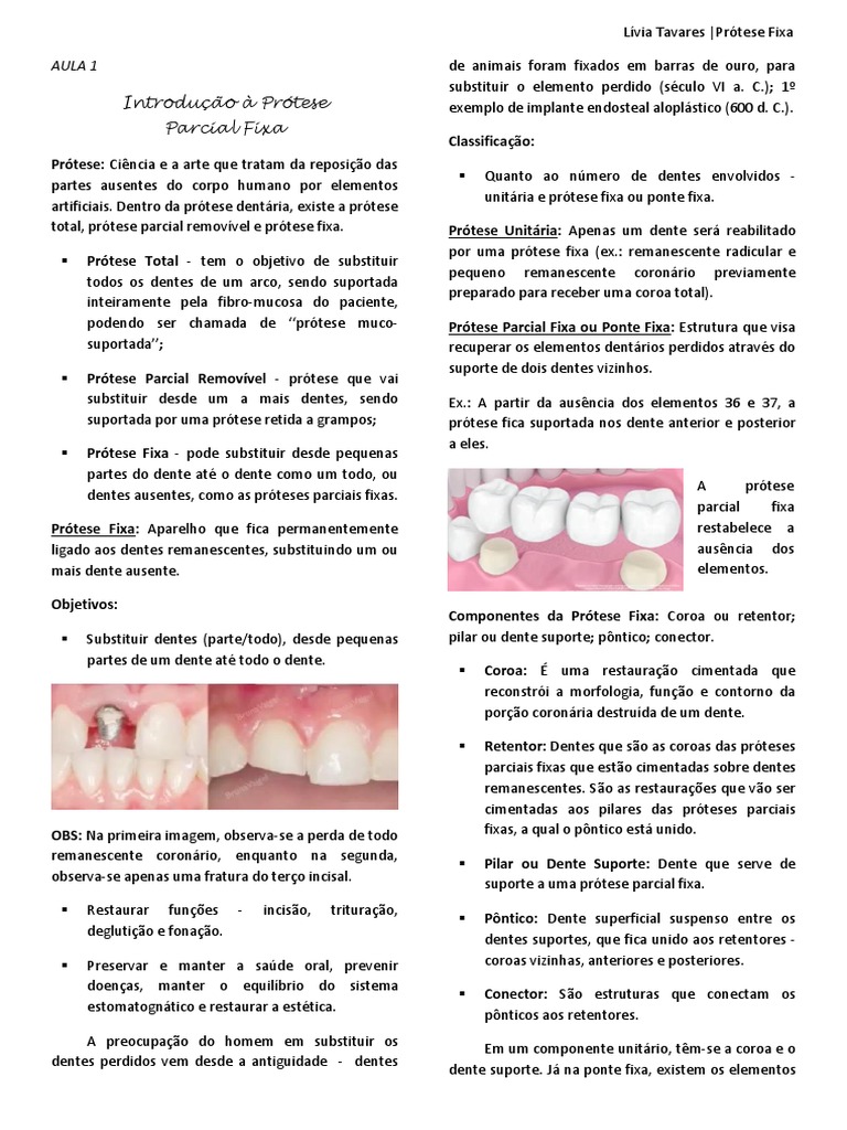 Introdução À Prótese Parcial Fixa | PDF | Dente | Prótese