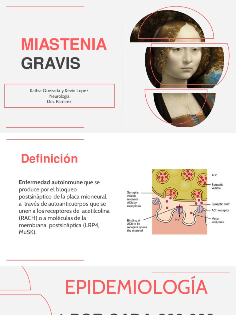 Miastenia Gravis | PDF | Medicina CLINICA | Especialidades Medicas Miastenia Gravis | PDF | Medicina CLINICA | Especialidades Medicas