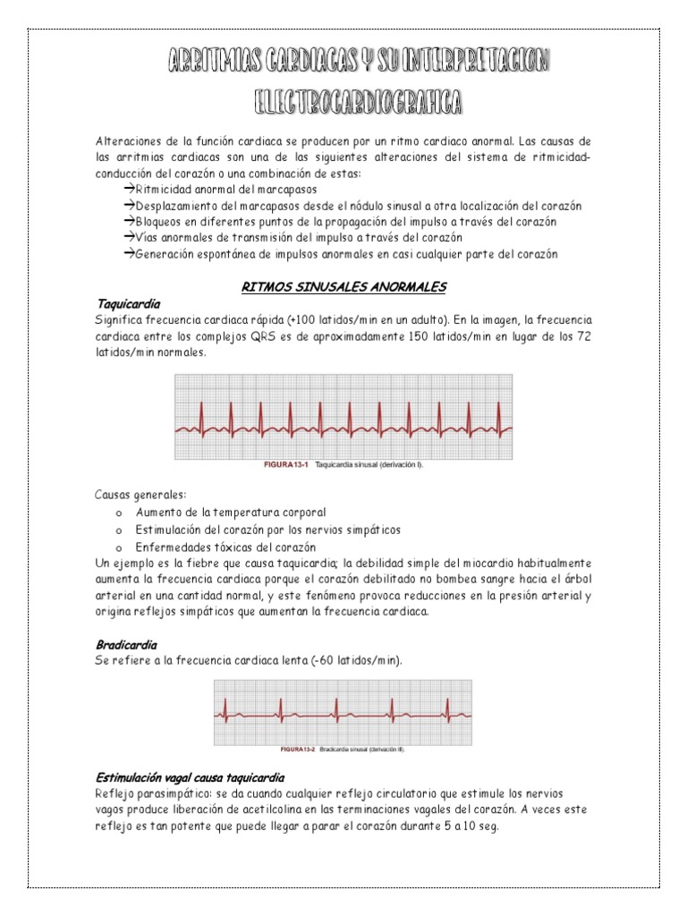 Arritmias Cardiacas | PDF | Electrocardiografia | Corazón