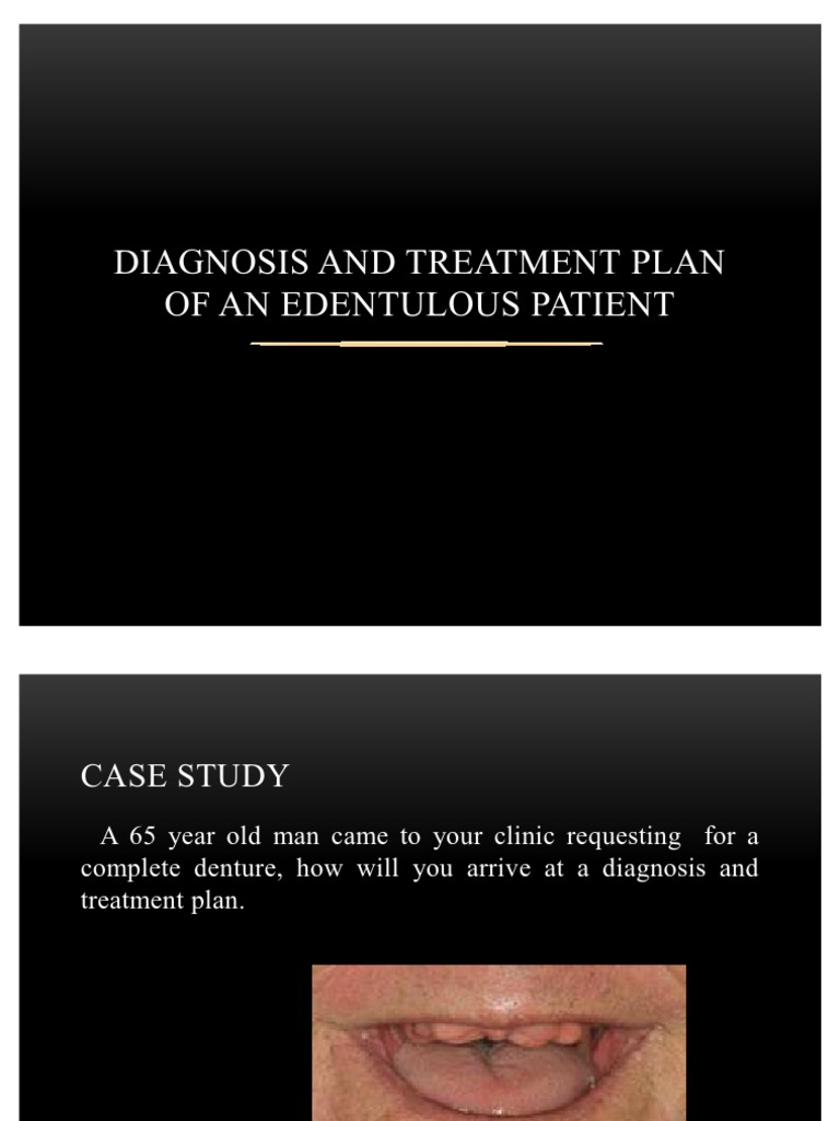 Diagnosis and Treatment Plan of An Edentulous Mouth | PDF | Dentistry ...