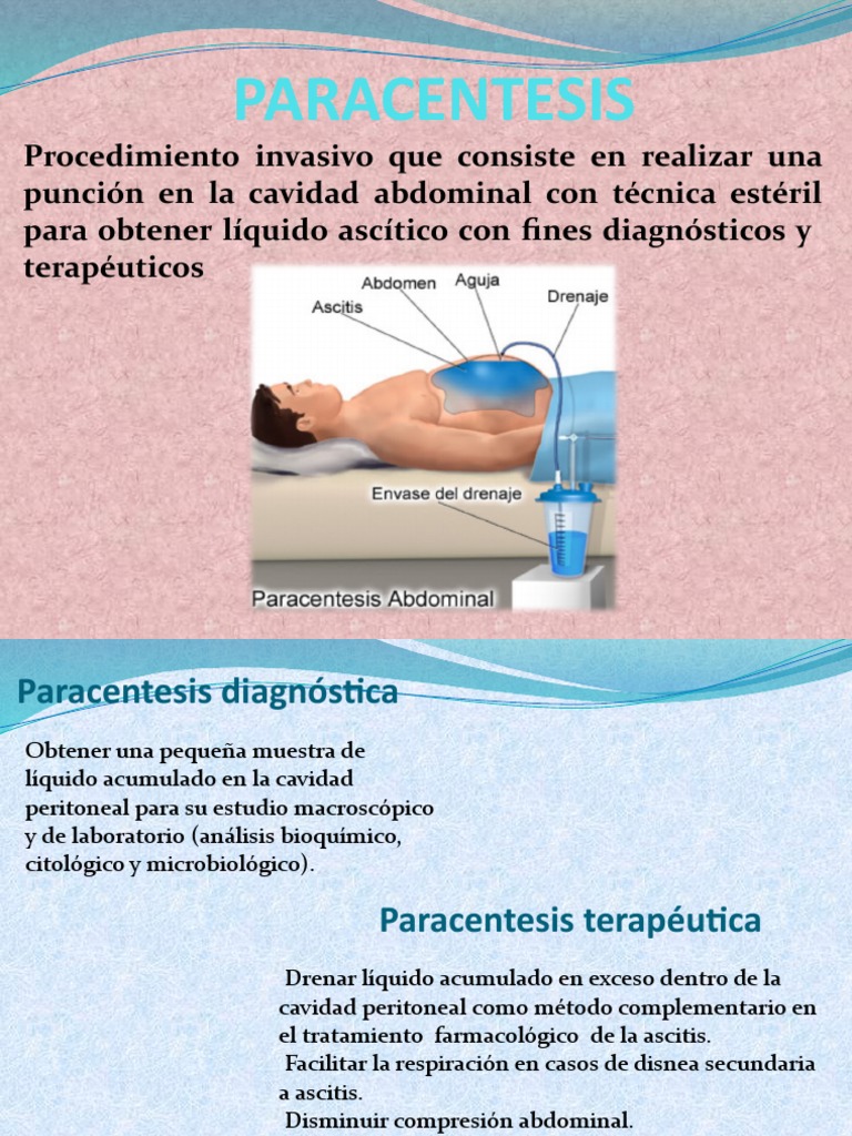Procedimiento de Paracentesis Abdominal | PDF | Especialidades Medicas ...