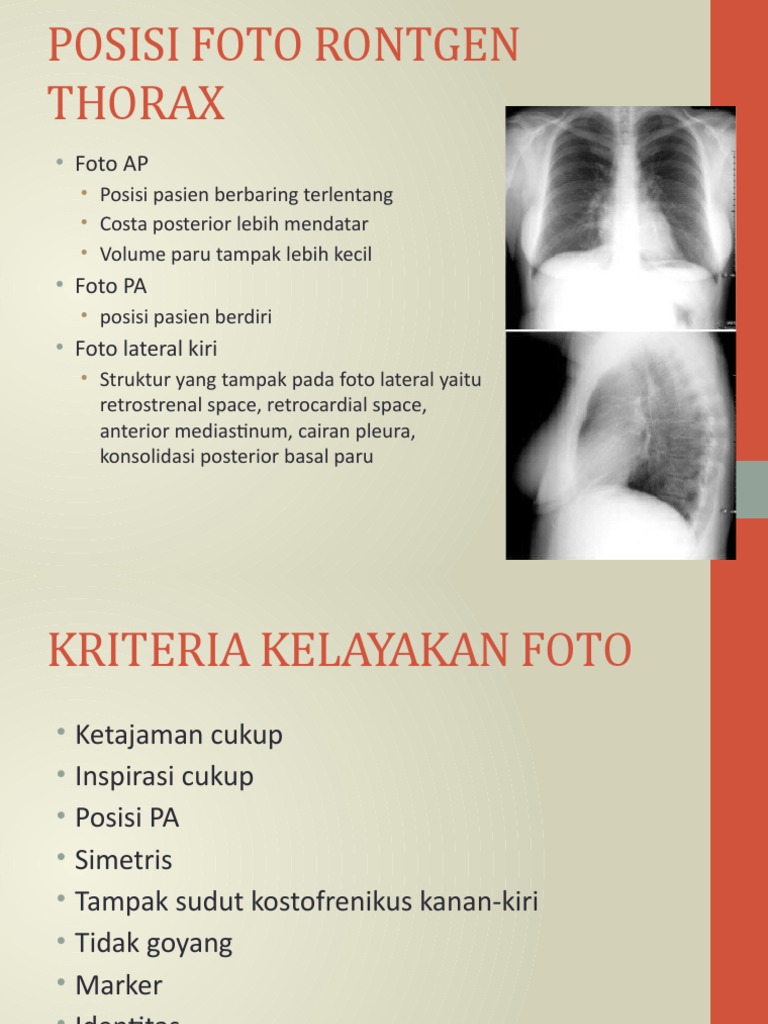 Rontgen Thorax | PDF