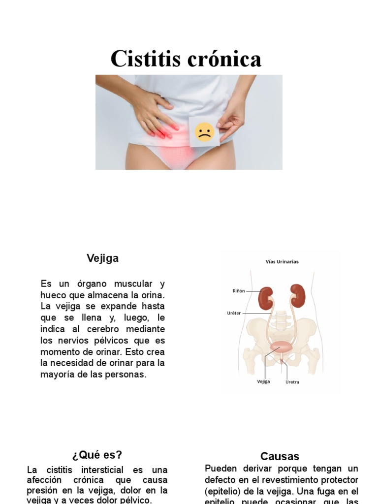 Cistitis Crónica: Síntomas y Tratamientos | PDF | Vejiga urinaria ...