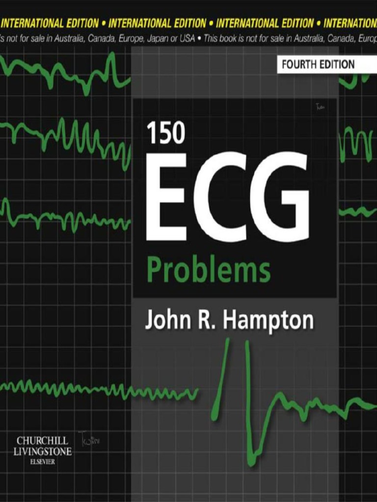 150 Ekg Vakası | PDF