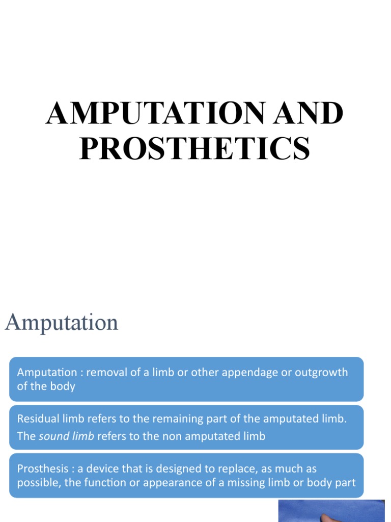 Amputation and Prosthetics: An Overview of Residual Limb Evaluation ...