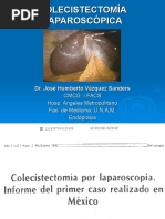 Sigmoidectomia Laparoscopica | PDF | Intestino grueso | Cirugía