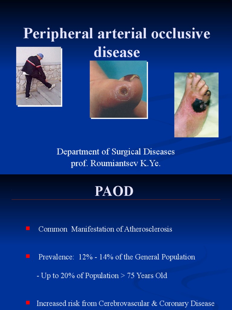 Peripheral Arterial Occlusion | PDF | Atherosclerosis | Atheroma