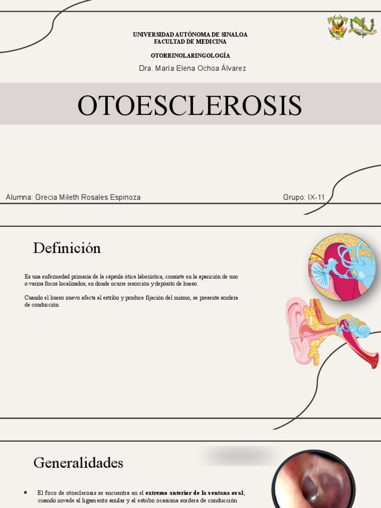 O Toe Sclerosis | PDF | Otorrinolaringología | Sistema Auditorio