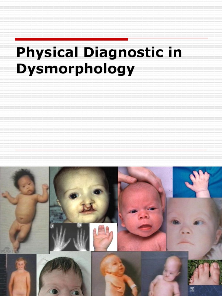 Physical Diagnostic in Dysmorphology | PDF | Genetic Disorder | Medical ...