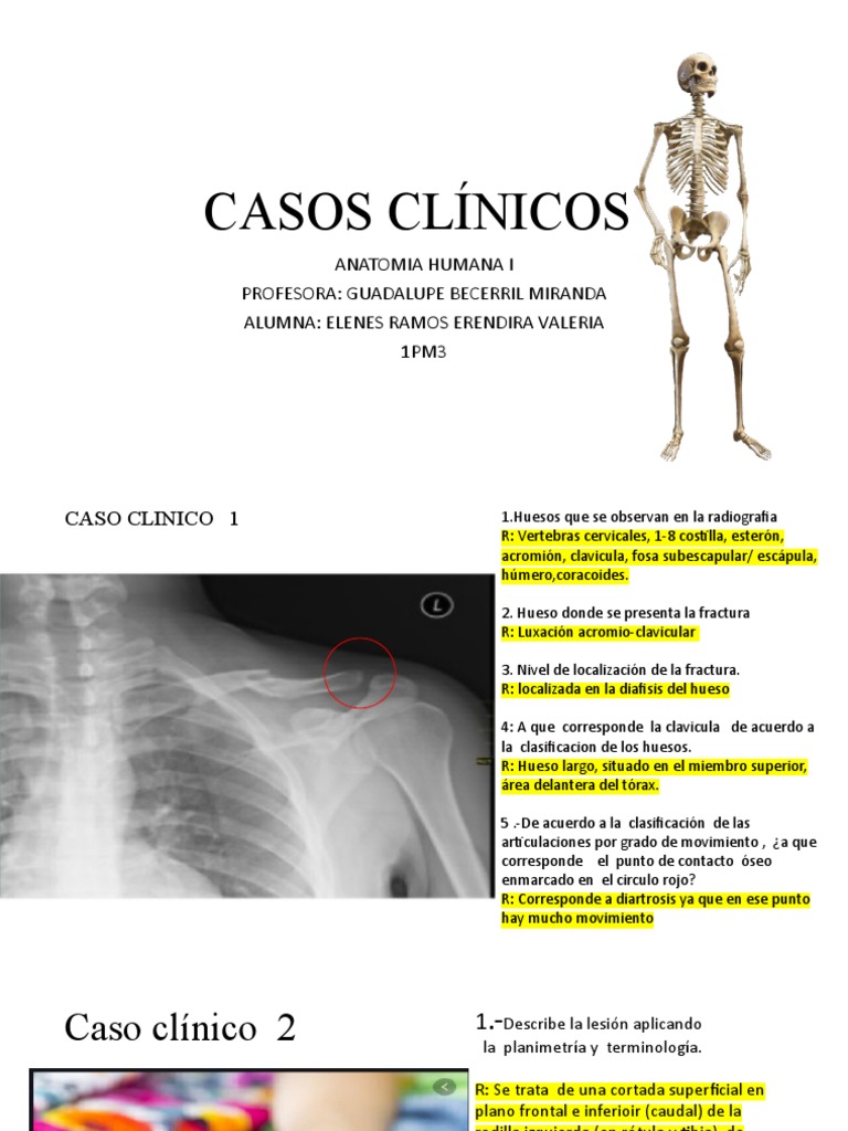 Casos Clínicos Anatomía | PDF | Articulación | Extremidades (anatomía)
