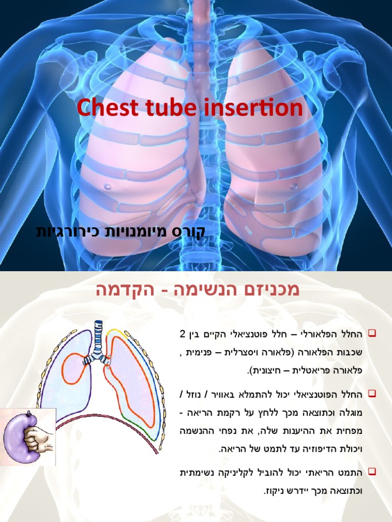 Chest Tube | PDF
