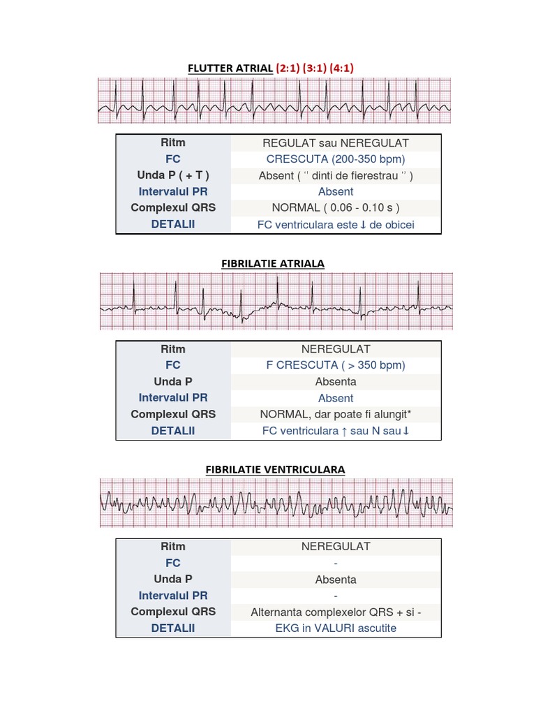 Ekg - Aritmii - Complet | PDF