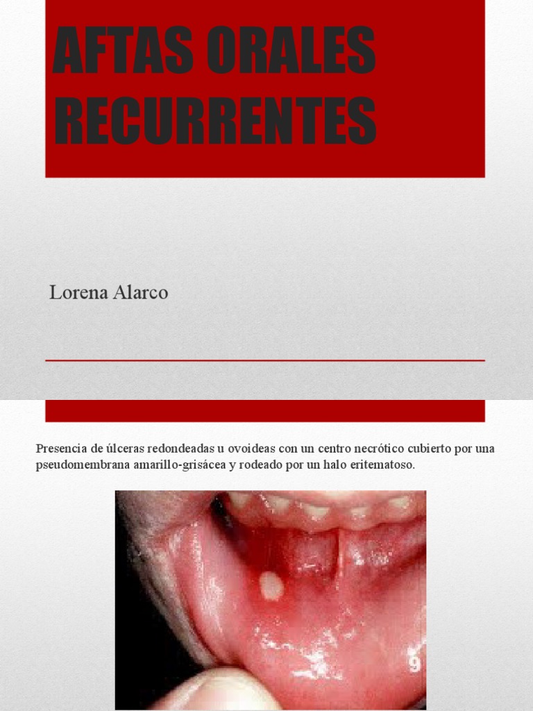 AFTAS ORALES RECURRENTES | PDF | Condiciones cutáneas | Ciencias de la ...