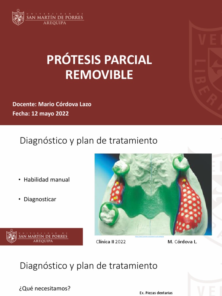 ppr | PDF | Dentadura postiza | Odontología