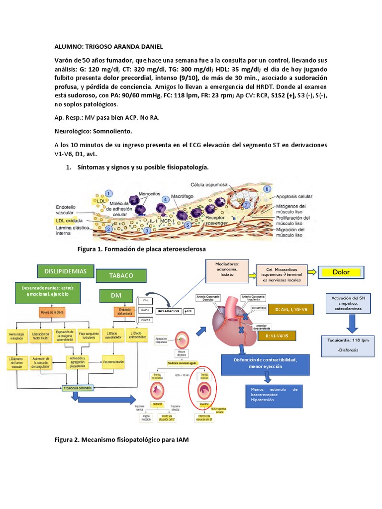 Informe - Caso Clinico Taller - Iam - Trigoso Aranda | PDF | Droga anti-inflamatoria libre de ...