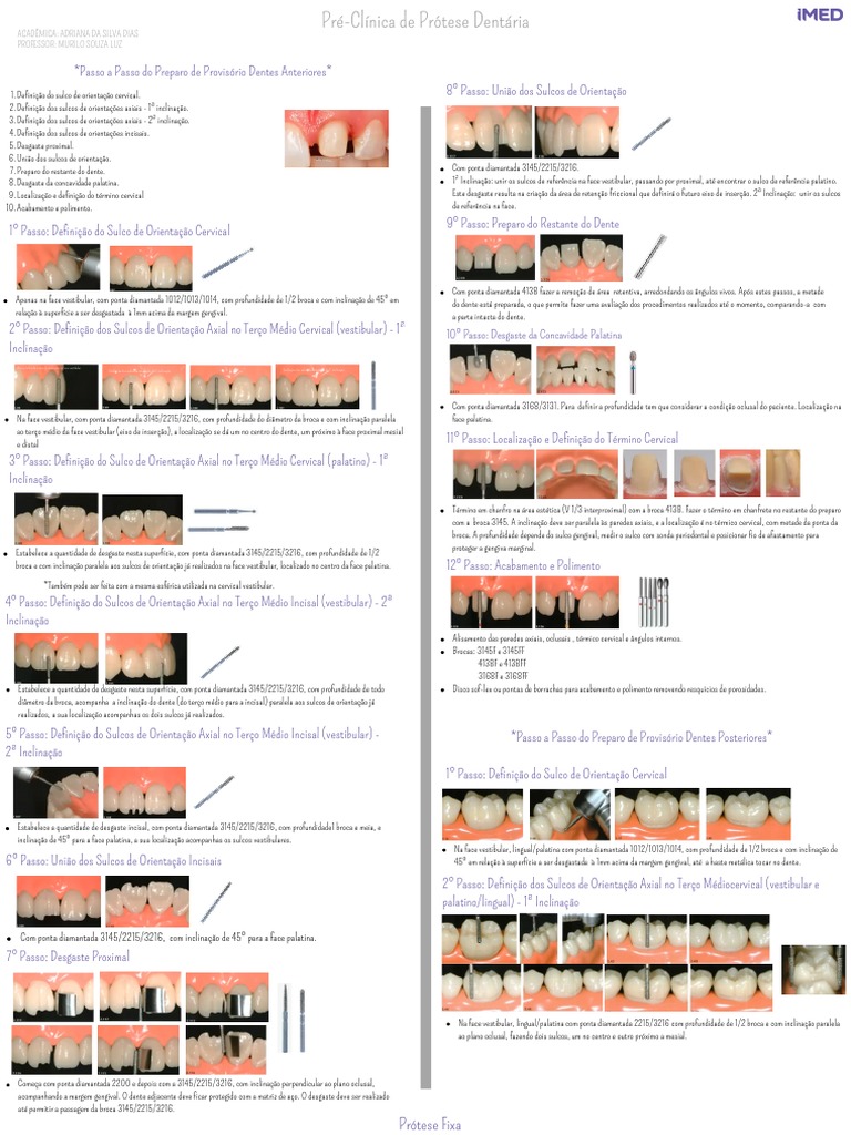 Passo a passo para preparo de provisórios em dentes anteriores e ...