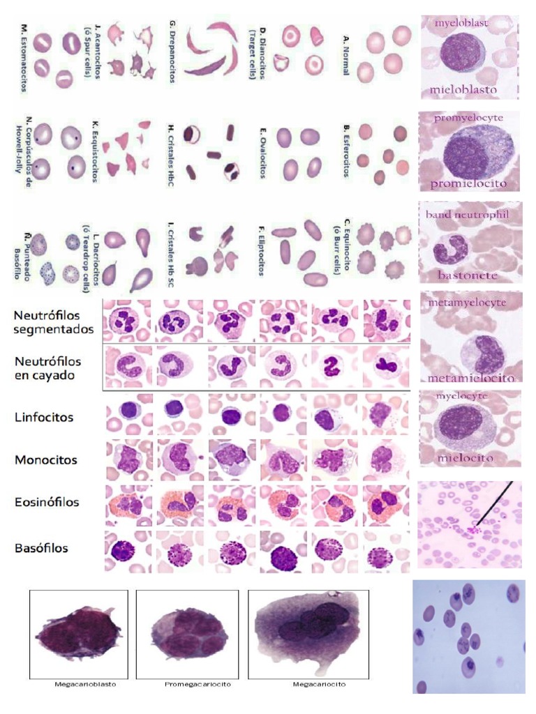 Hematologia Imagenes | PDF