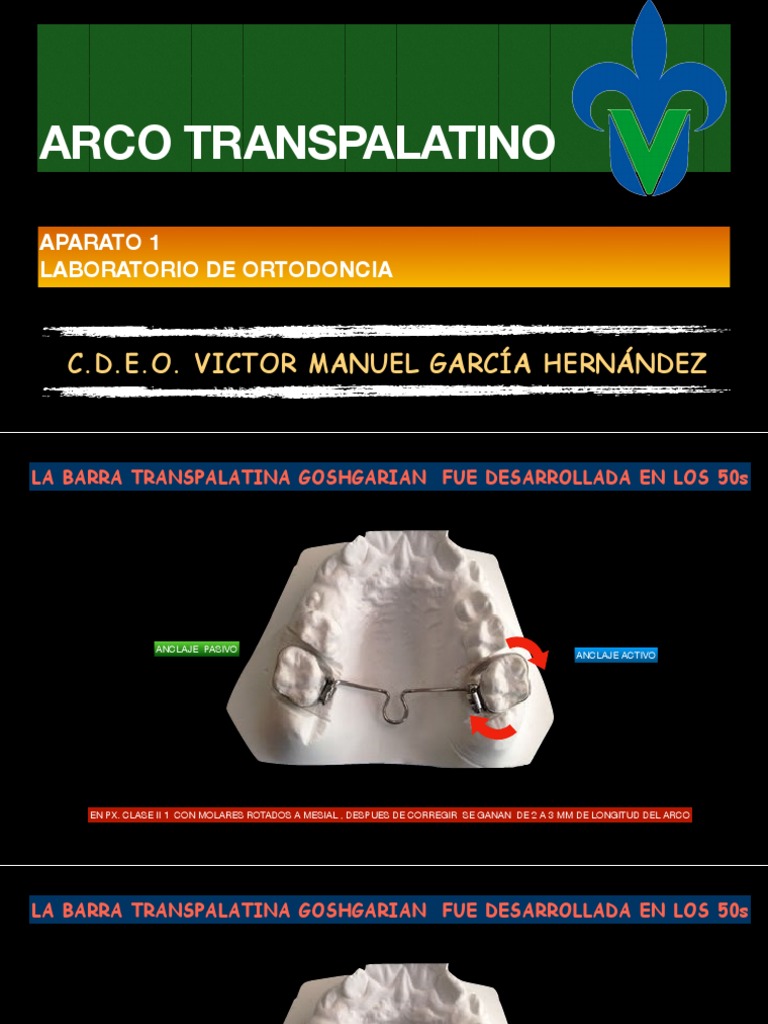 PDF Aparato 1 Arco Transpalatino | PDF | Ingeniería mecánica