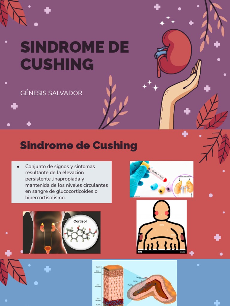 Comprendiendo el Síndrome de Cushing | PDF | Hormona ...