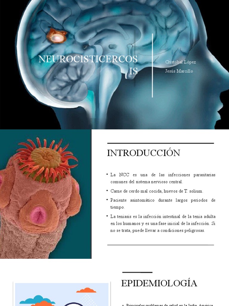 Neurocisticercosis | PDF | Inmunología | Ciencias de la Salud
